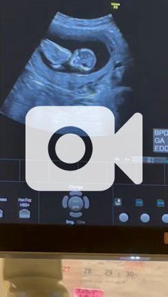 12w3d 眠い… | mamapi7のブログ