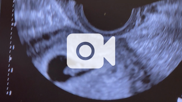 ♡6w6d...心拍確認..♡ | Rusaは心配性‼